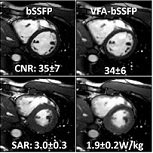 Subashini Srinivasan